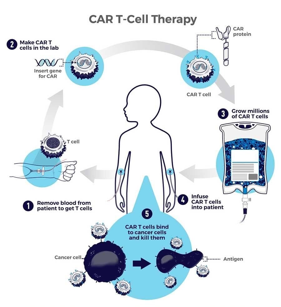 Understanding the Antigen-Binding Domains in CAR T-Cells