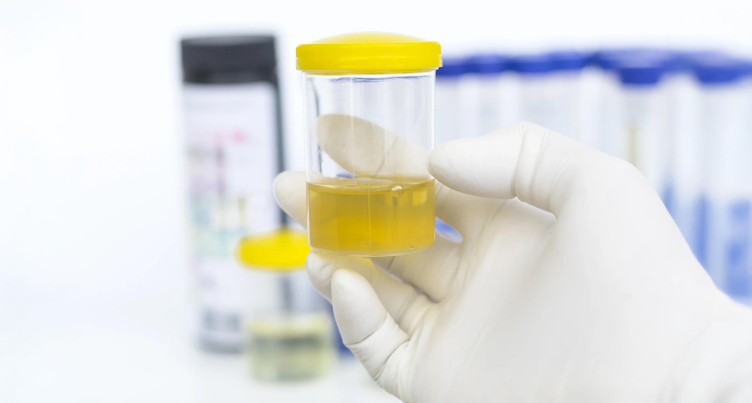 Building Effective Drugs of Abuse Assays: Conjugates, Kinetics, and ...